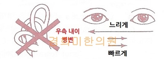 안구진탕눈동자 떨림 증상 원인 치료 네이버 블로그