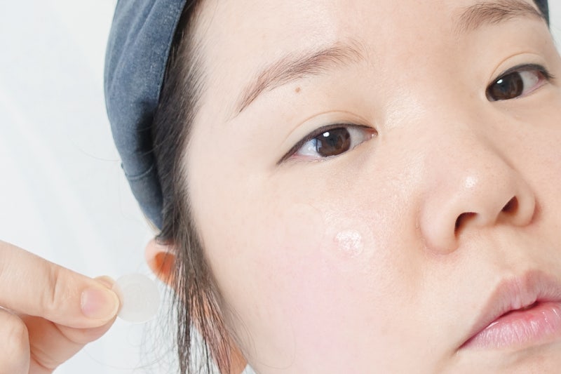 트러블 딱 그만~ 니들패치 아크로패스 트러블큐어 후기 네이버 블로그