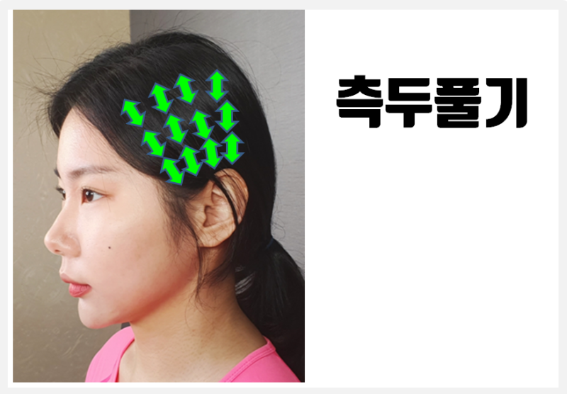 긴 얼굴 짧아보이는 교정운동 중안부 긴 얼굴 중안부 짧아지는법 해부학적처방얼굴자가교정 12탄 얼굴 작아지는법