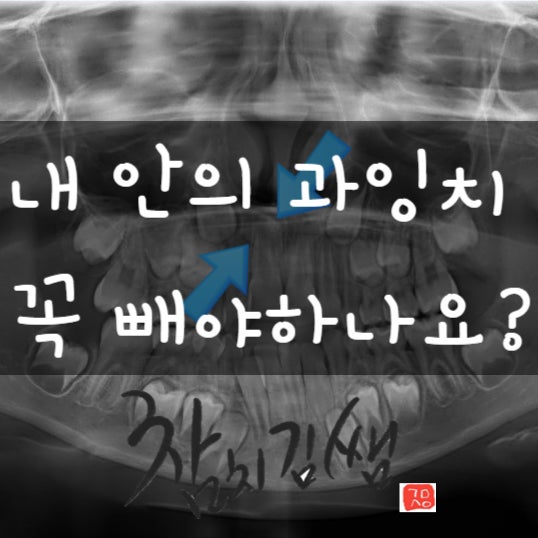 과잉치 발치 정중 과잉치 발치 매복치아 꼭 발치해야 하나요 네이버 블로그