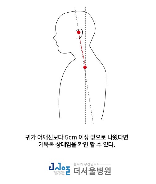 더서울병원에서 알려드리는 거북목 자가진단법 And 스트레칭법 네이버 블로그