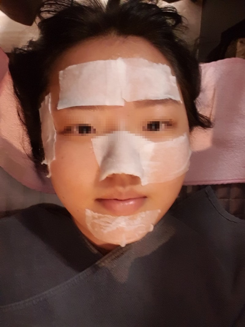 잠실새내피부과 모공프락셀로 모공줄이는시술 후기 네이버 블로그