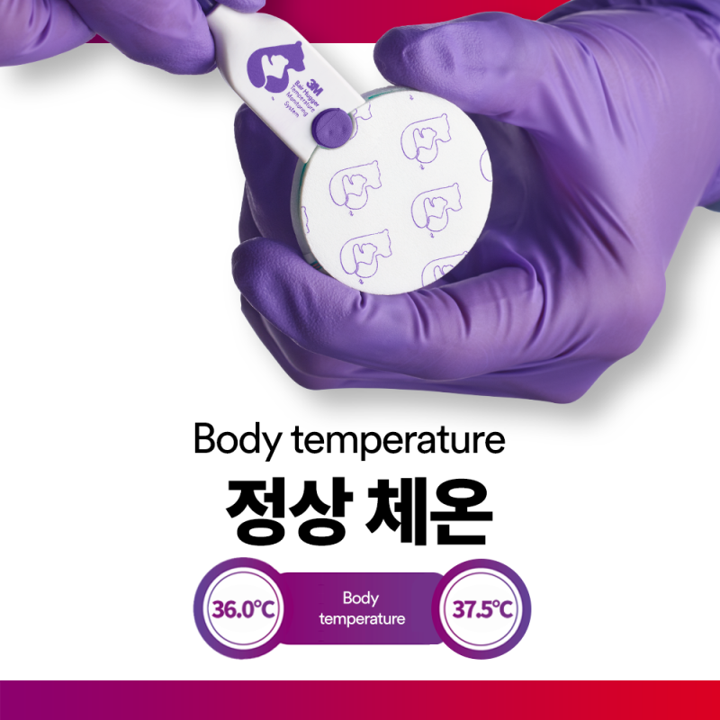 수술 전, 중, 후 3M™ Bair Hugger Control Unit으로 중심 체온을 측정하세요 : 네이버 블로그