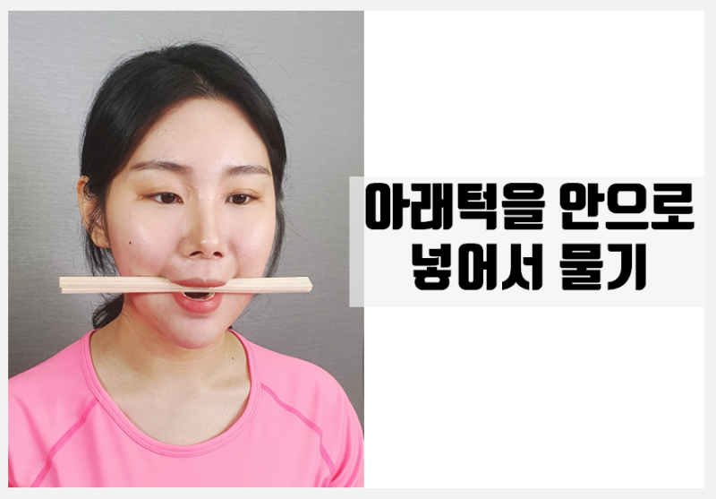 긴 얼굴 짧아보이는 주걱턱 교정 주걱턱 교정운동 아래턱이 긴 얼굴 마사지 해부학적처방리샘자가교정 13탄 네이버 블로그