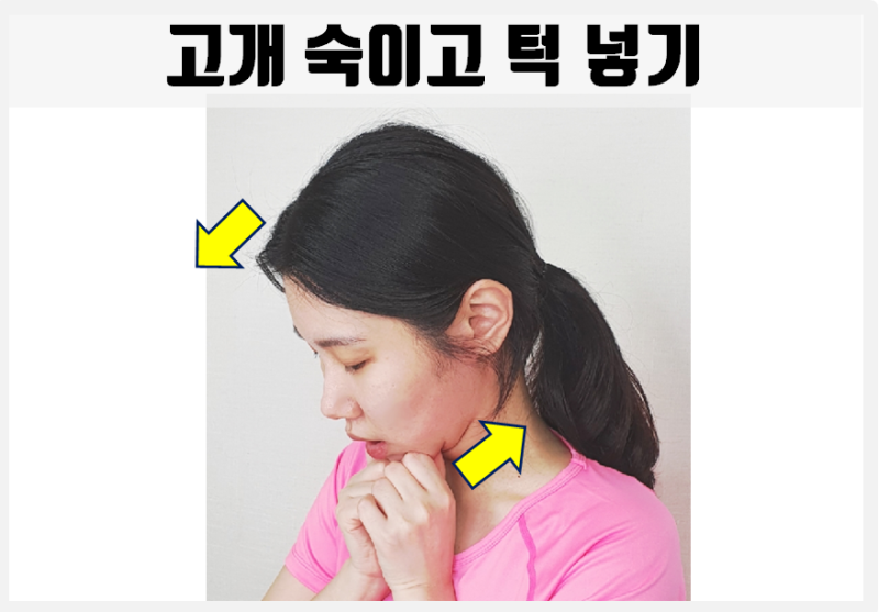 긴 얼굴 짧아보이는 주걱턱 교정 주걱턱 교정운동 아래턱이 긴 얼굴 마사지 해부학적처방리샘자가교정 13탄 네이버 블로그