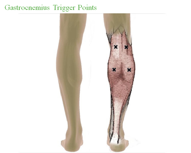 비복근(Gastrocnemius) '장딴지근' : 네이버 블로그