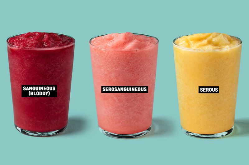 Sanguineous, Serosanguineous, Serous 의 차이점 : 네이버 블로그