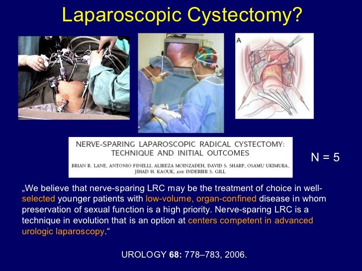근치적 방광절제술의 술기와 골반림프절 절제술(Technical steps of Radical Cystectomy and ...