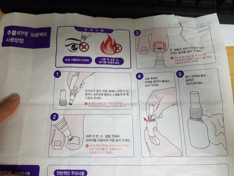 발톱무좀약 치료방법 주블리아 외용액 최고네요 네이버 블로그