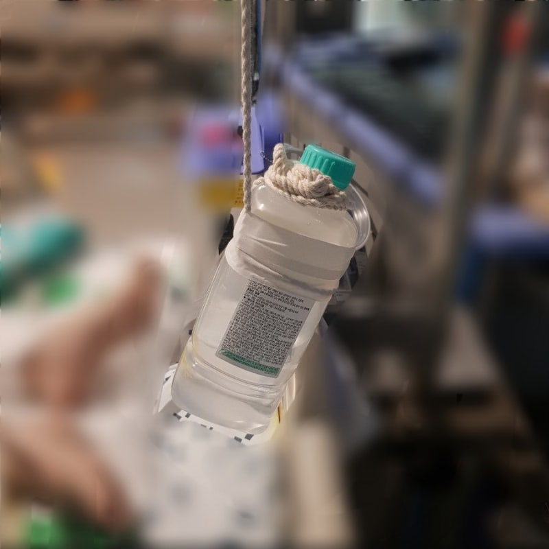 식도정맥류 출혈 치료 - SB tube(Sengstaken-Blakemore tube) : 네이버 블로그