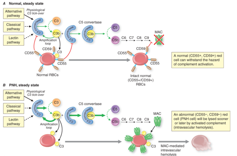 [Hematology] Paroxysmal Nocturnal Hemoglobinuria (PNH) : 네이버 블로그