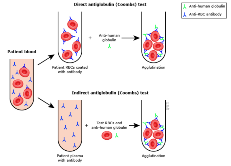 용혈성 빈혈 (hemolytic anemia), terminology : 네이버 블로그