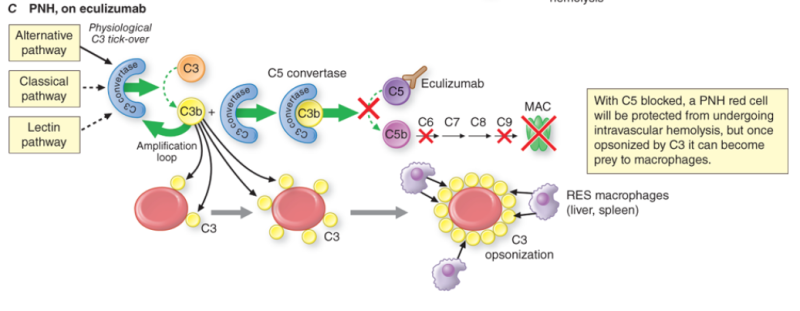 [Hematology] Paroxysmal Nocturnal Hemoglobinuria (PNH) : 네이버 블로그