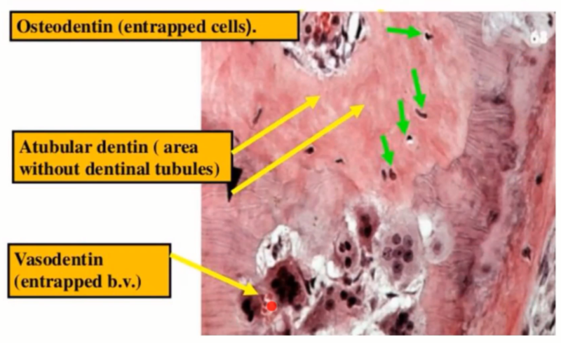 [구강조직학] 상아질(Dentin)의 구조 : 네이버 블로그