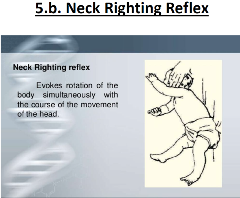 뇌성마비/정상발달 설명해주는 남자 - 조산아이들의 치료의 중요성 2 : 네이버 블로그