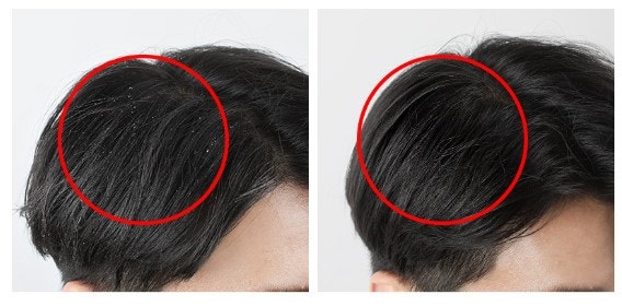 남자남성 강력 하드 워터 스프레이 다슈 포 맨 메가 홀드 슈퍼 스프레이 언제까지 가스 스프레이 네이버 블로그