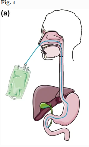 GI)PTCS, PTBD, EUS, ERCP, ENBD 등등등 완전 초초초초 쉽게 쓴다2222 : 네이버 블로그