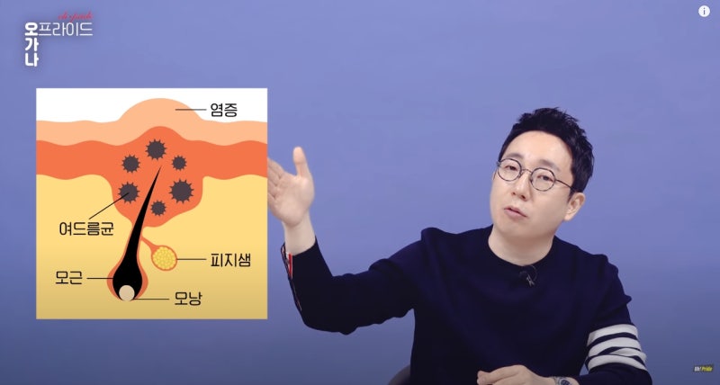 여드름 흉터 치료 가장 확실한 치료법 알려드립니다 피부과전문의 오가나 네이버 블로그