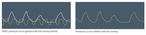 NAVA mode for Servo-n ventilator (핵심) : 네이버 블로그
