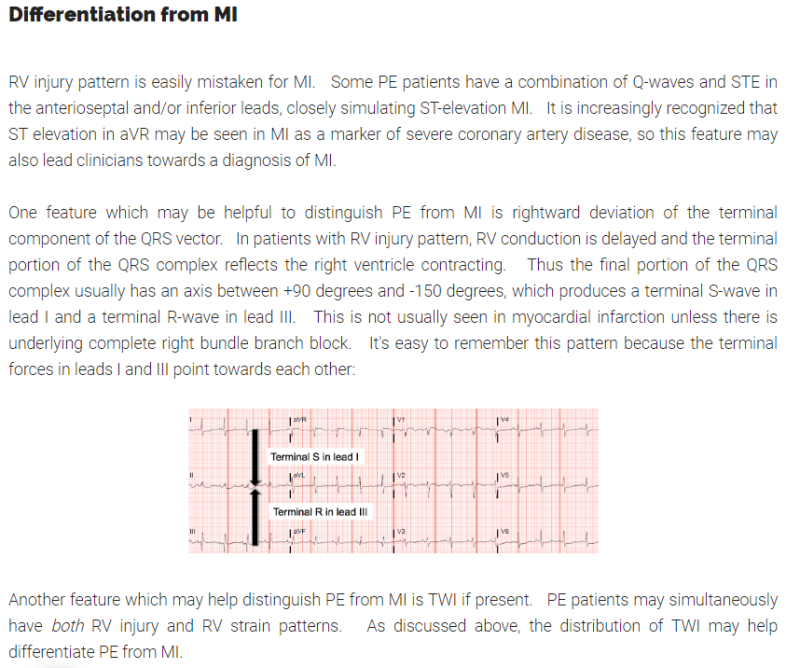 Large PE’s can often mimic STEMI with ST-segment elevation (especially ...