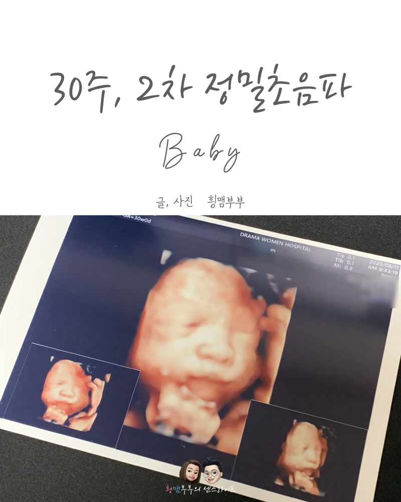 임신 30주 2차 정밀초음파 태아자세 몸무게 콩팥크기 심장구멍 네이버 블로그