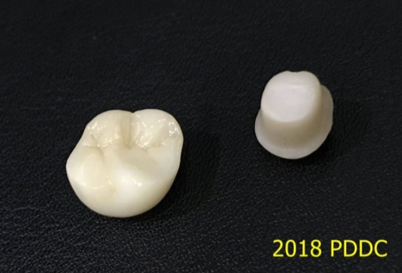 Well Lock 웰락 (Bicon type) 프레미엄 임플란트 : 네이버 블로그
