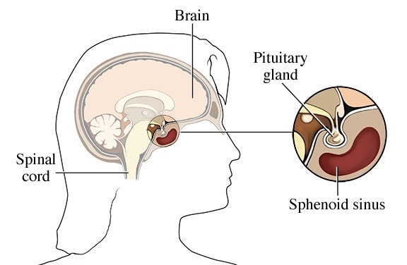 TSA : transsphenoidal aproach surgery : 네이버 블로그