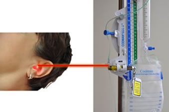 의학용어EVD 배액은 왜 하는지 아시나요? : 네이버 블로그
