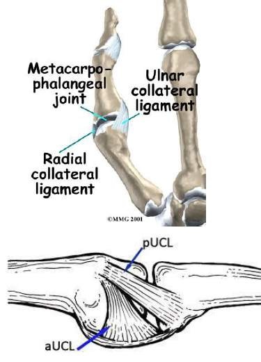 UCL repair & RCL repair (Thumb) : 네이버 블로그