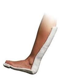 splint 종류 : 네이버 블로그