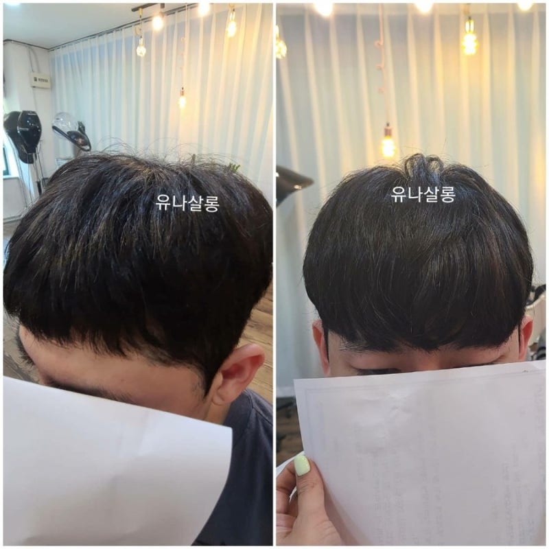 일산 남자m자 탈모 남자붙임머리로 커버 네이버 블로그