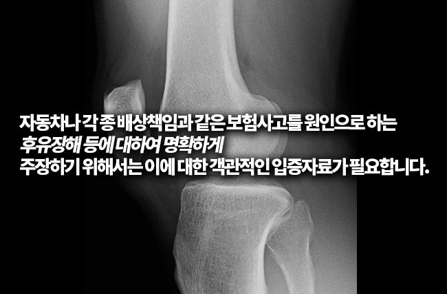 무릎뼈 골절 후유장해 보험금 청구 보상전문가 네이버 블로그