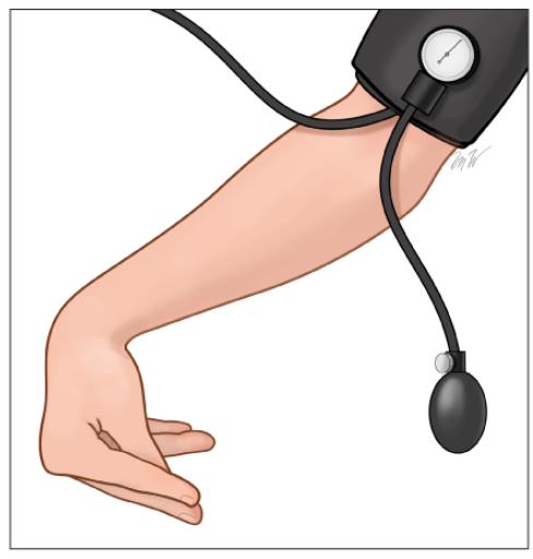 저칼슘혈증, 급성 증상, 테타니, Hypocalcemia, acute manifestations, tetany : 네이버 블로그