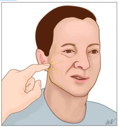 저칼슘혈증, 급성 증상, 테타니, Hypocalcemia, acute manifestations, tetany : 네이버 블로그