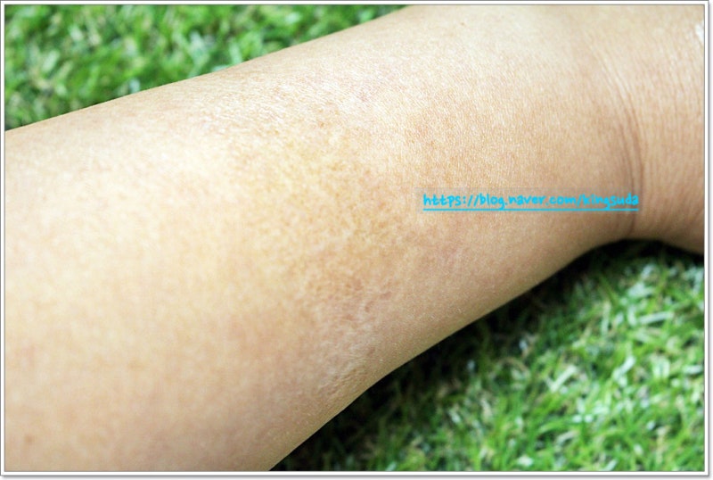 아이 흉터제거연고 스카이지겔 상처자국 연하게 도와줘요. : 네이버 블로그