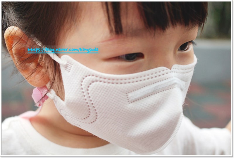 아이 흉터제거연고 스카이지겔 상처자국 연하게 도와줘요. : 네이버 블로그