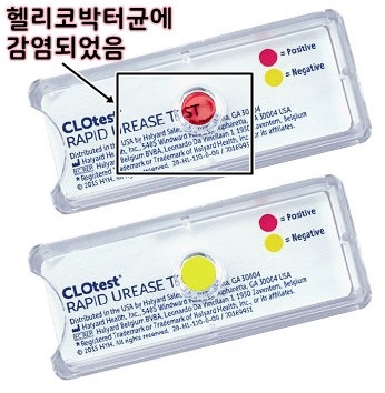 요소호기검사 CLO TEST 목적 방법 비용 등 간호사가 정리 : 네이버 블로그