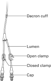 [Rn] 중심정맥관 Central venous catheter,CVP (C-line, Hickman, Mac catheter ...