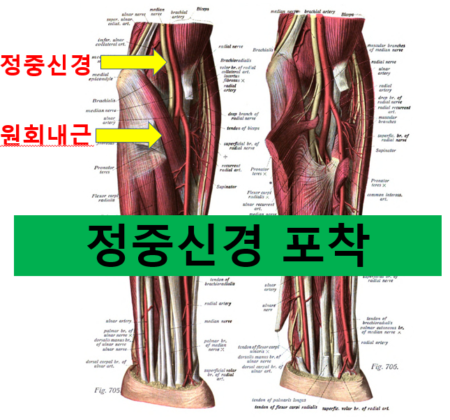원회내근 증후군pronator Teres Syndrome 손저림 안쪽 팔꿈치통증 천안아산 달천한의원 네이버 블로그