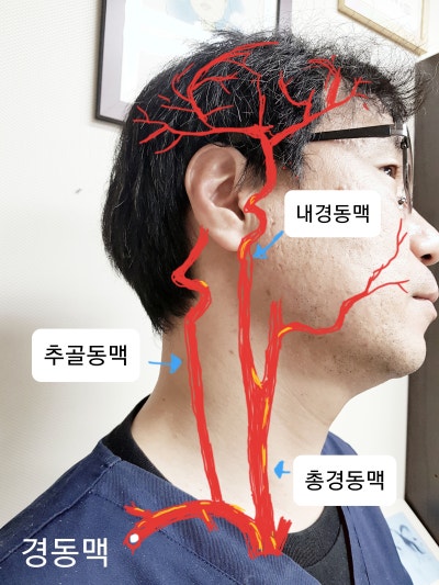 경동맥협착증 과 경동맥초음파 표준검사지침 네이버 블로그