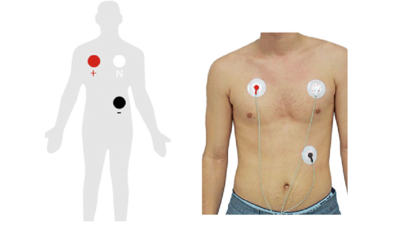 200715 OSNS#2_EKG, ECG 얄팍한 study, : 네이버 블로그