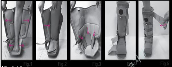 발목보조기 ROM AIR SHIELD WALKER 사용법 / Ankle orthosis 천안바디렉스 : 네이버 블로그