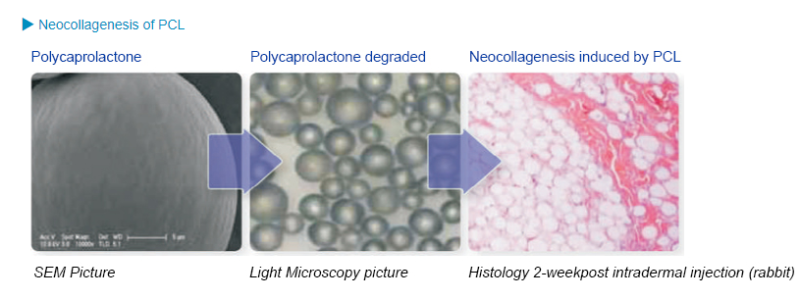 PCL, polycaprolactone,엘란쎄 -PCL 스킨부스터 - (1) : 네이버 블로그