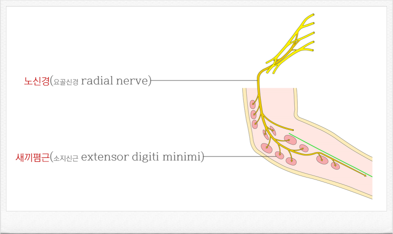 해부학 근육학 아래팔근육forearm Muscle 뒤칸 새끼폄근소지신근ㆍextensor Digiti
