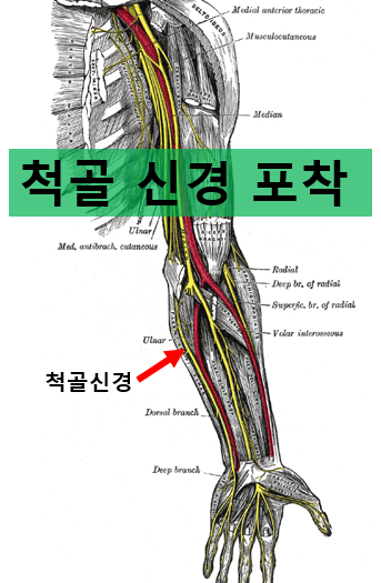 척골신경포착ulnar Nerve Entrapment 45번째 손가락이 저리고 아픔 천안아산 달천한의원 네이버 블로그