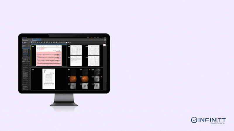 [인피니트헬스케어 솔루션] 알아두면 쓸모많은 신비한 CIS 이야기 - INFINITT CIS, 디지털 진료환경을 구현하다 ...