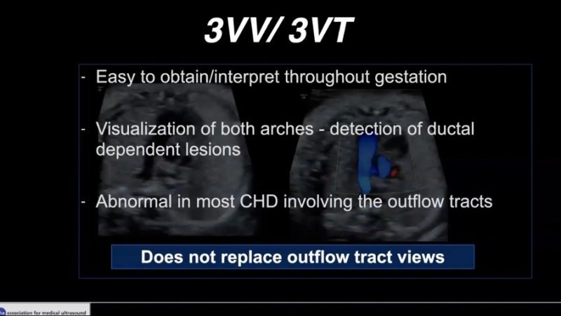 Q42.Fetal 3 vessel views/ 16번째 AIUM 합격 인증서와 태아 초음파 강의 요약 : 네이버 블로그