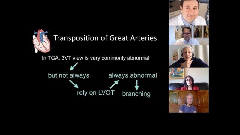 Q43.TOF의 다양한 분류와 TGA 강의/Alfred Abuhamad 의 Abnormal outflow tract 와 3VV ...