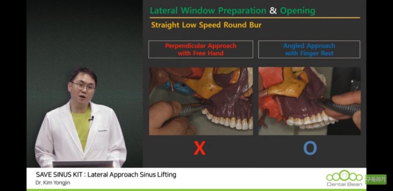 Save sinus kit by dentis를 이용한 lateral approach - 김용진 원장님 : 네이버 블로그