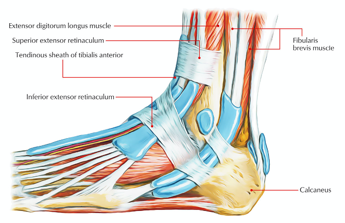 Ankle MBO(Modified Brostrom Operation) - 발목 인대 봉합술 : 네이버 블로그